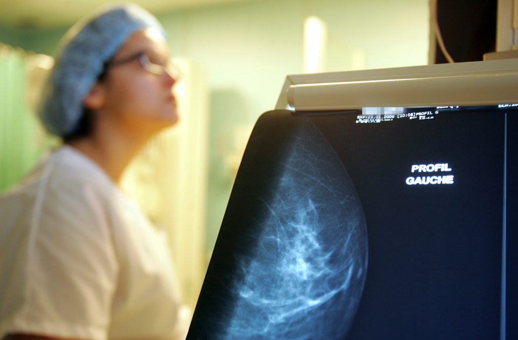 Researchers train AI model to detect breast cancer - The Scoop