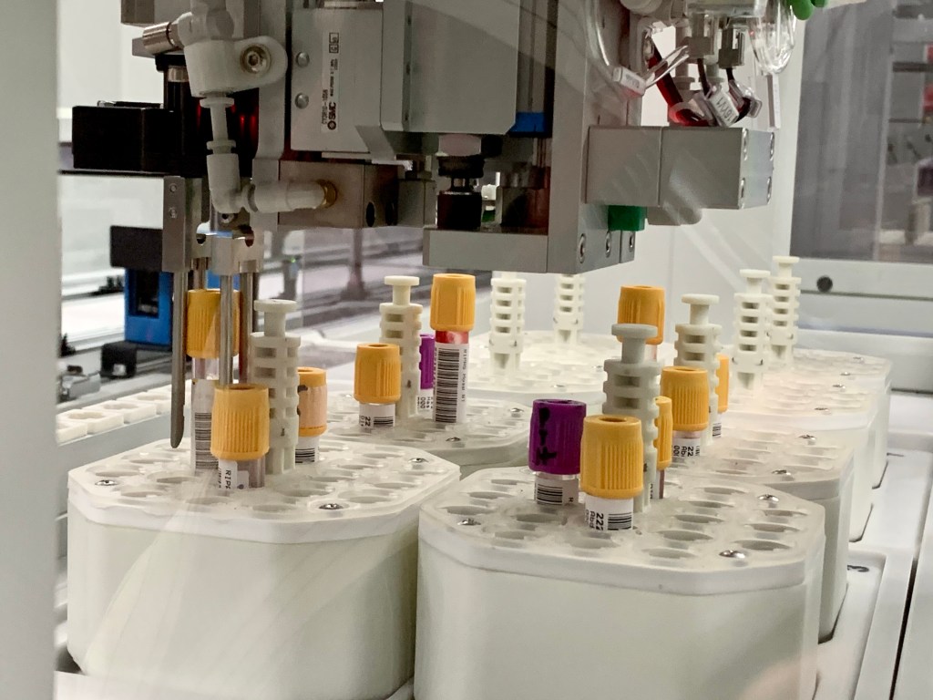 Patients can expect 'more accurate, faster' lab test results - The Scoop